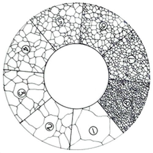 Grain size analysis of metal structure - Visual Inspection & Microscope ...
